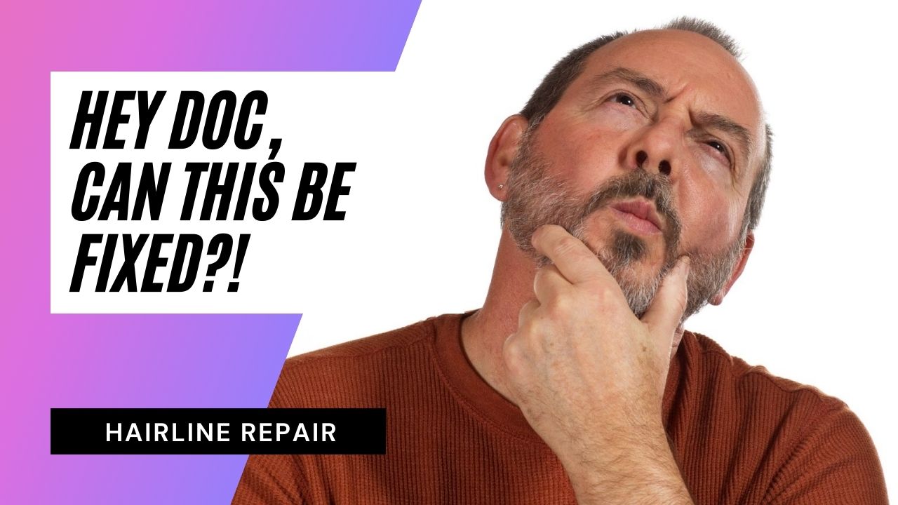 Hey doc, can this be fixed? (Hair Transplant Repairs | BHR Clinic ...